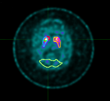 Nuclear Medicine - Maryland - Chesapeake Medical Imaging